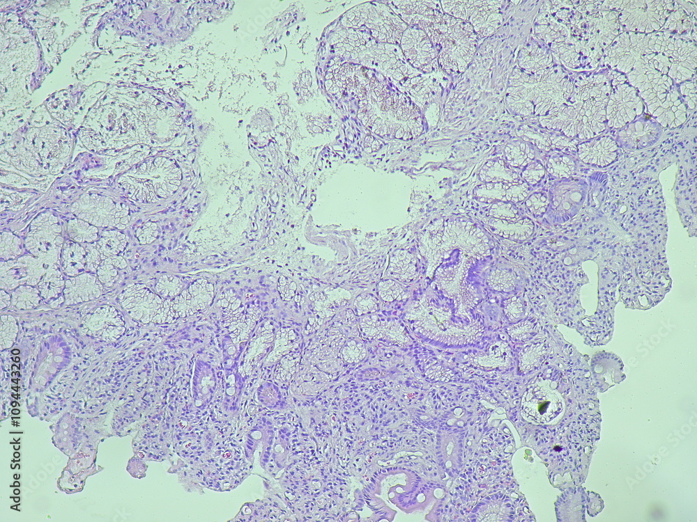 Human cell tissue under microscope in pathology laboratory. Microscopic ...