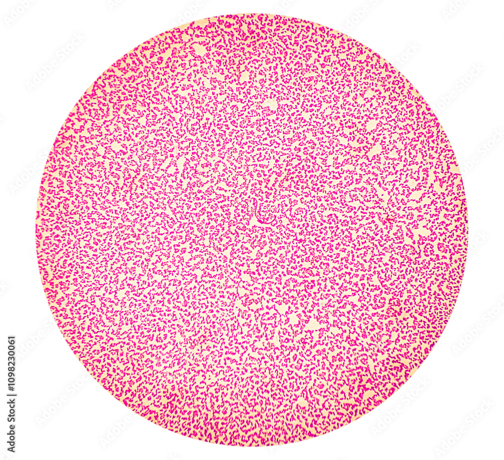 Salmonellosis. Microscopic view of gram stained slide from blood agar ...