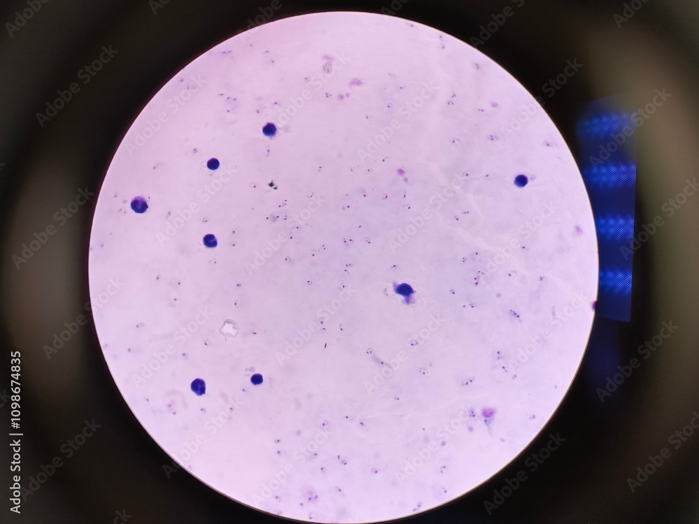 Plasmodium falciparum is a unicellular protozoan parasite of humans, and the deadliest species ...