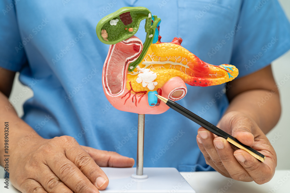 Pancreatitis, pancreatic cancer, Asian doctor with pancreas ...