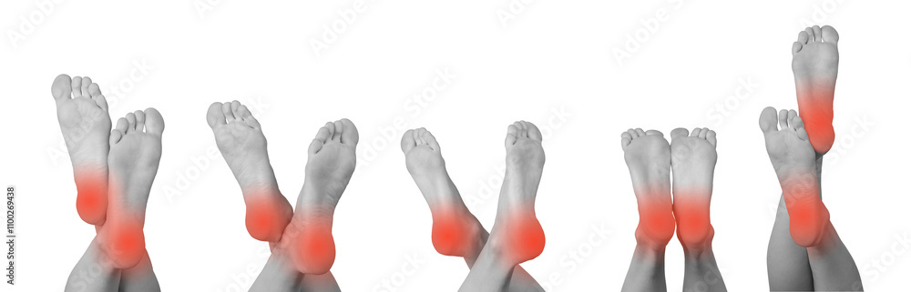 Set of female feet showing symptoms of pain and injury, including heel ...