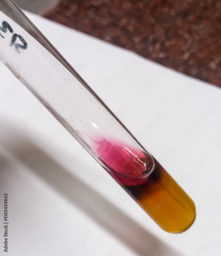 Salmonella detection method by using Triple Sugar Iron (TSI) Agar in ...