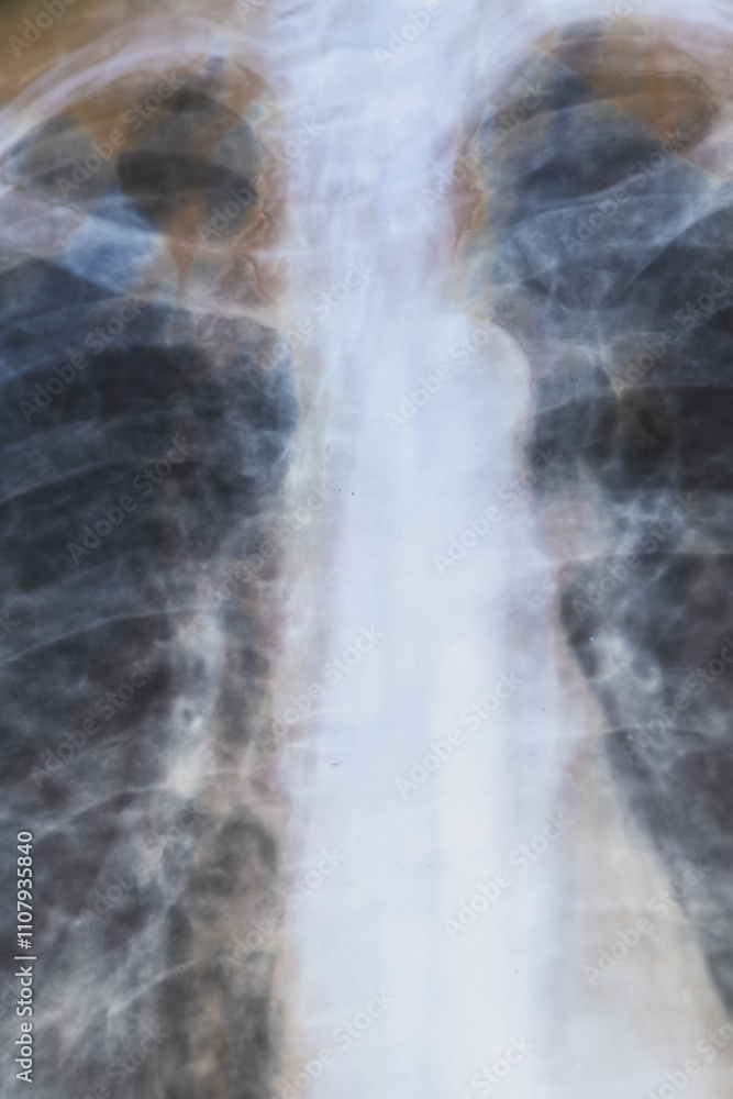 Vertical X-ray scan of Human bones disease. Spine cancer. Doctor learn ...