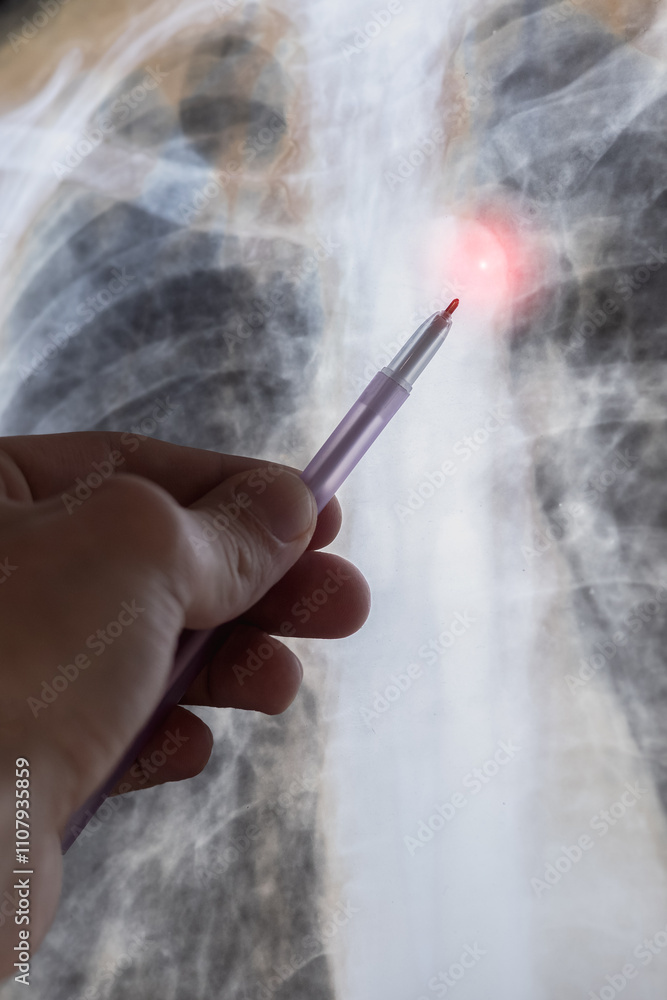 Vertical X-ray scan of Human bones disease. Spine cancer. Doctor learn ...