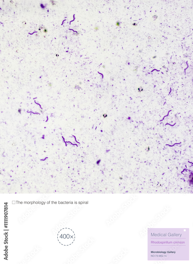 Crimson red spirochetes is a spiral shaped bacterium that is Gram ...