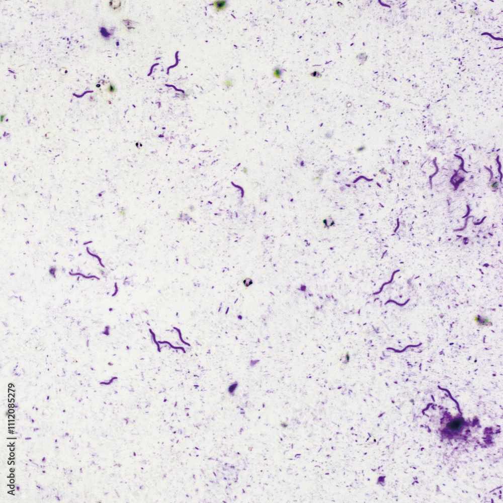 Crimson red spirochetes is a spiral shaped bacterium that is Gram ...