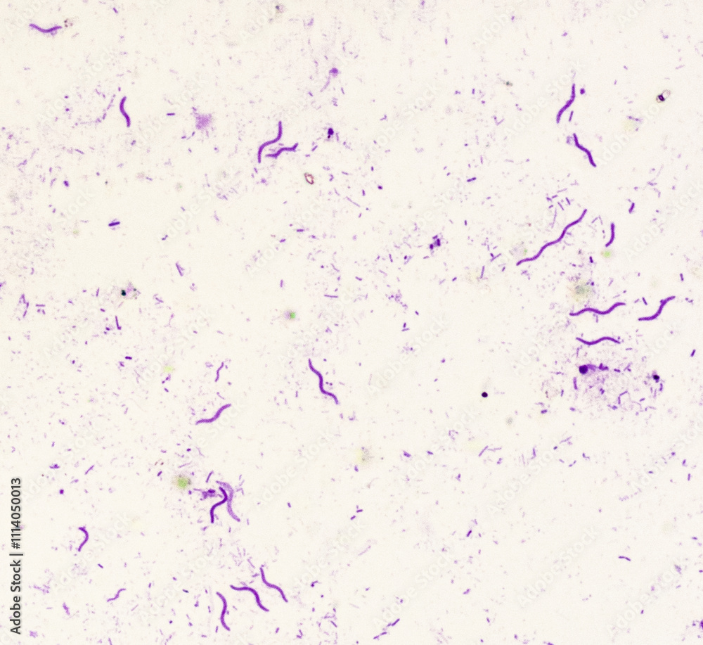 Crimson red spirochetes is a spiral shaped bacterium that is Gram ...