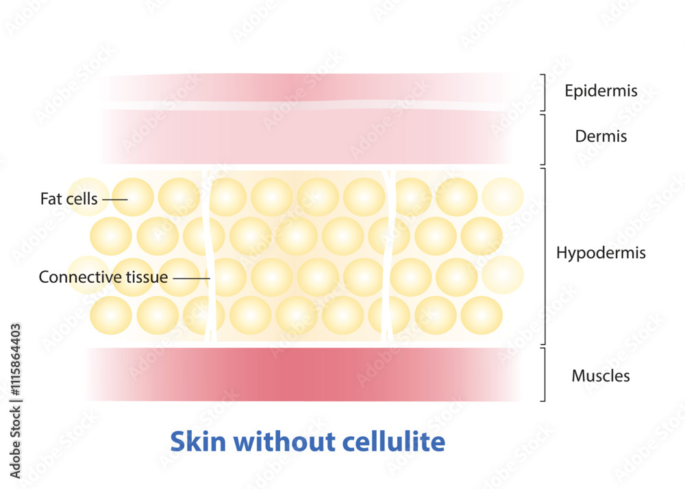 Formation of skin without cellulite vector illustration isolated on ...