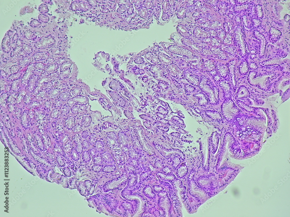 Human cell tissue under microscope in pathology laboratory. Microscopic ...