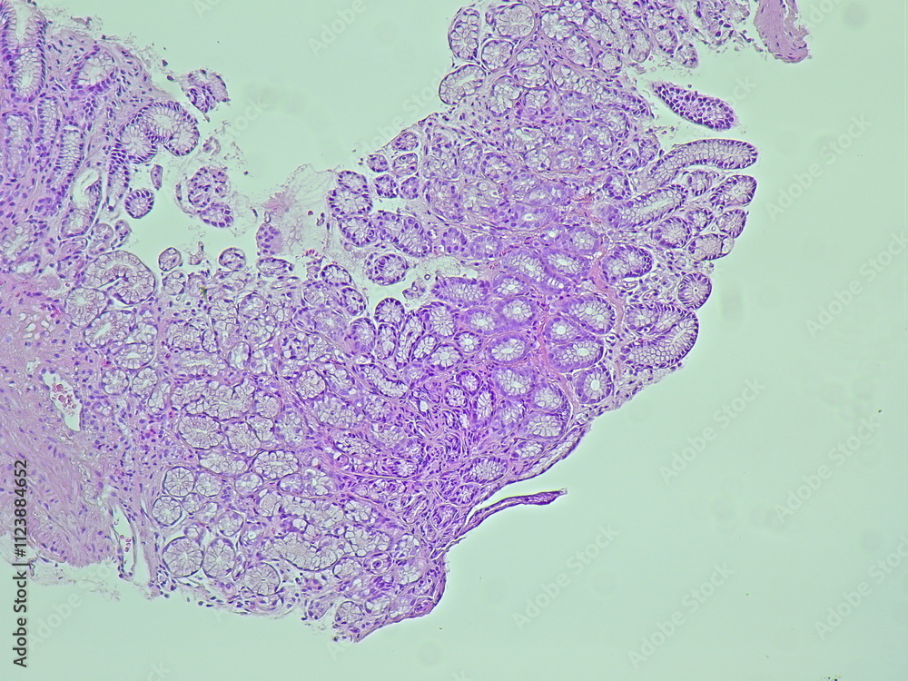 Human cell tissue under microscope in pathology laboratory. Microscopic ...