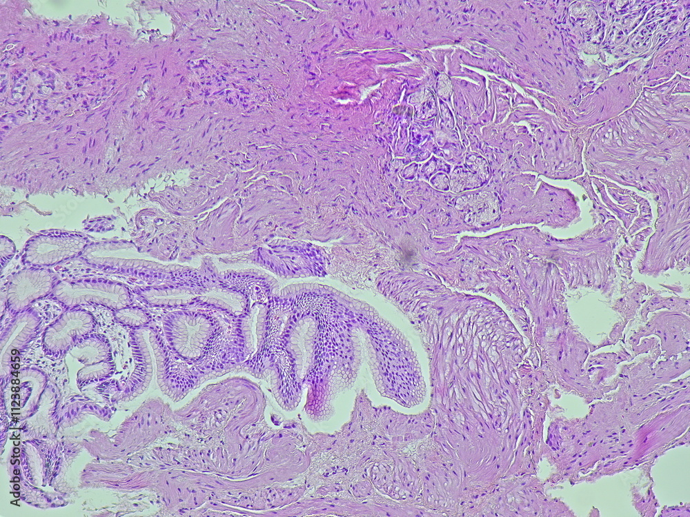 Human cell tissue under microscope in pathology laboratory. Microscopic ...