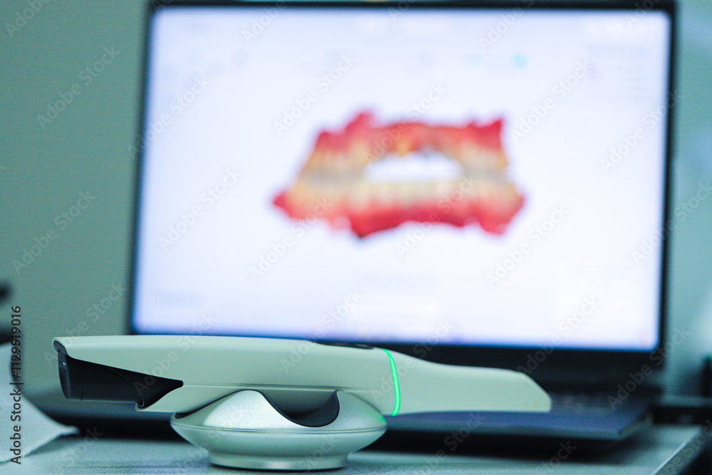 Intraoral digital scanner used in dental digital dentistry. A scanning ...