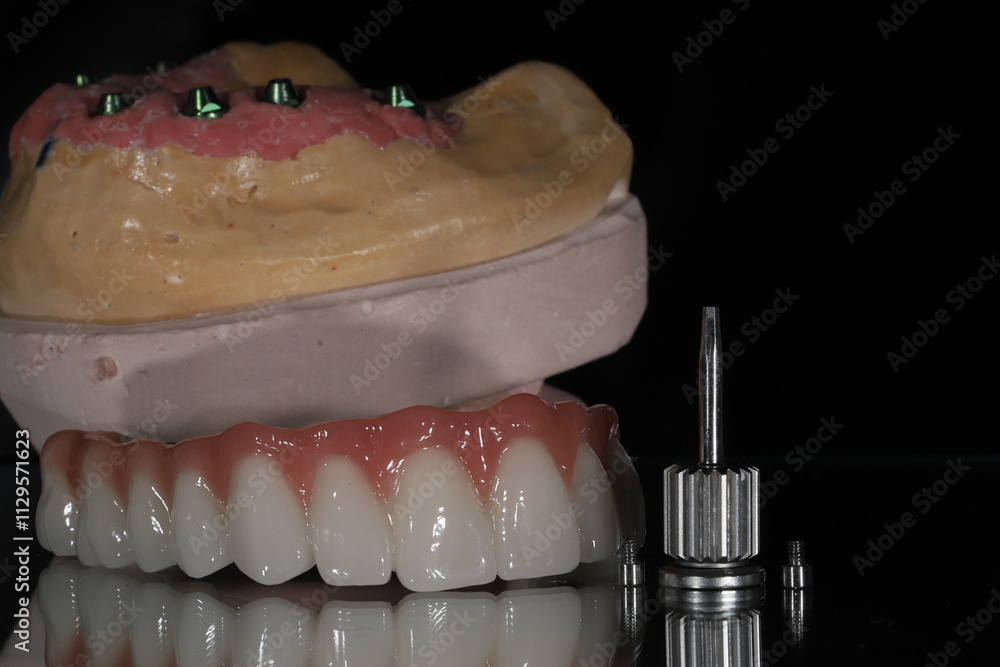 Full-arch dental prosthesis torque wrench and dental implant wrench ...