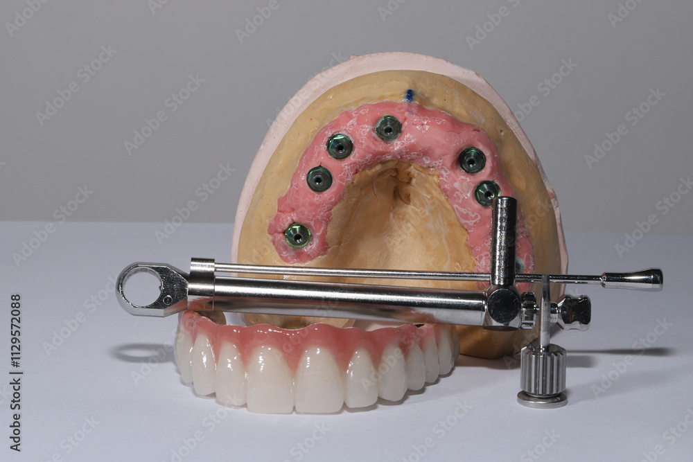 Full-arch dental prosthesis torque wrench and dental implant wrench ...