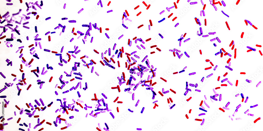 Gram stain. A microscopy technique that differentiates Gram-positive ...