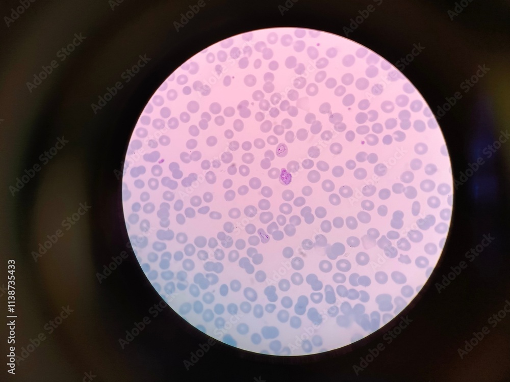 Plasmodium vivax is a protozoal parasite and a human pathogen. This ...