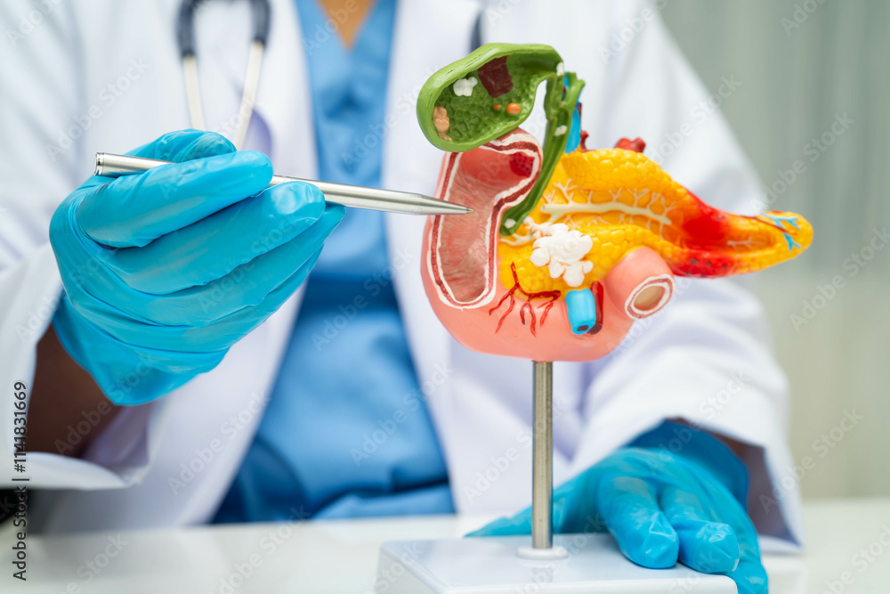 Pancreatitis, pancreatic cancer, Asian doctor with pancreas ...