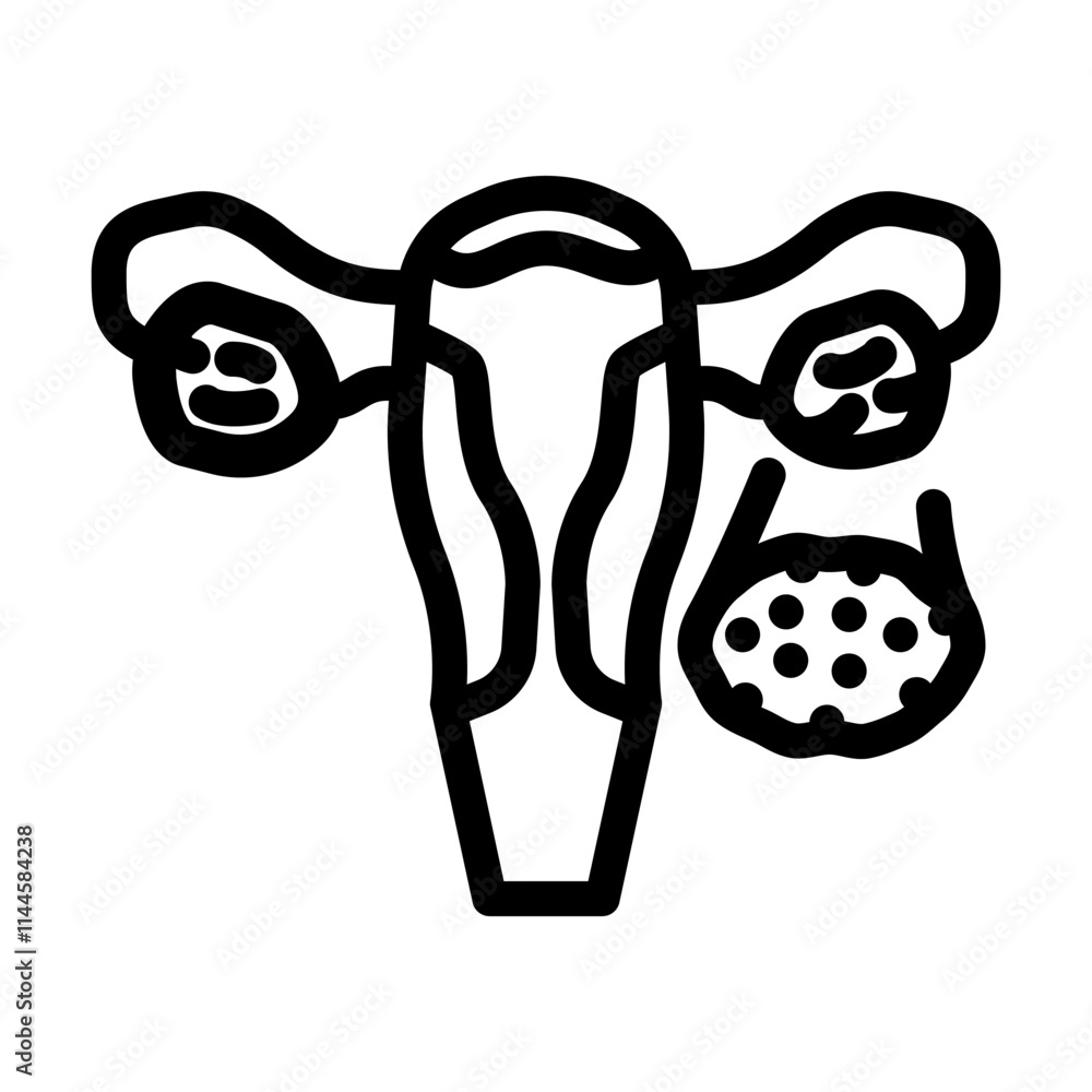 polycystic ovary syndrome woman disease line icon vector. polycystic ...