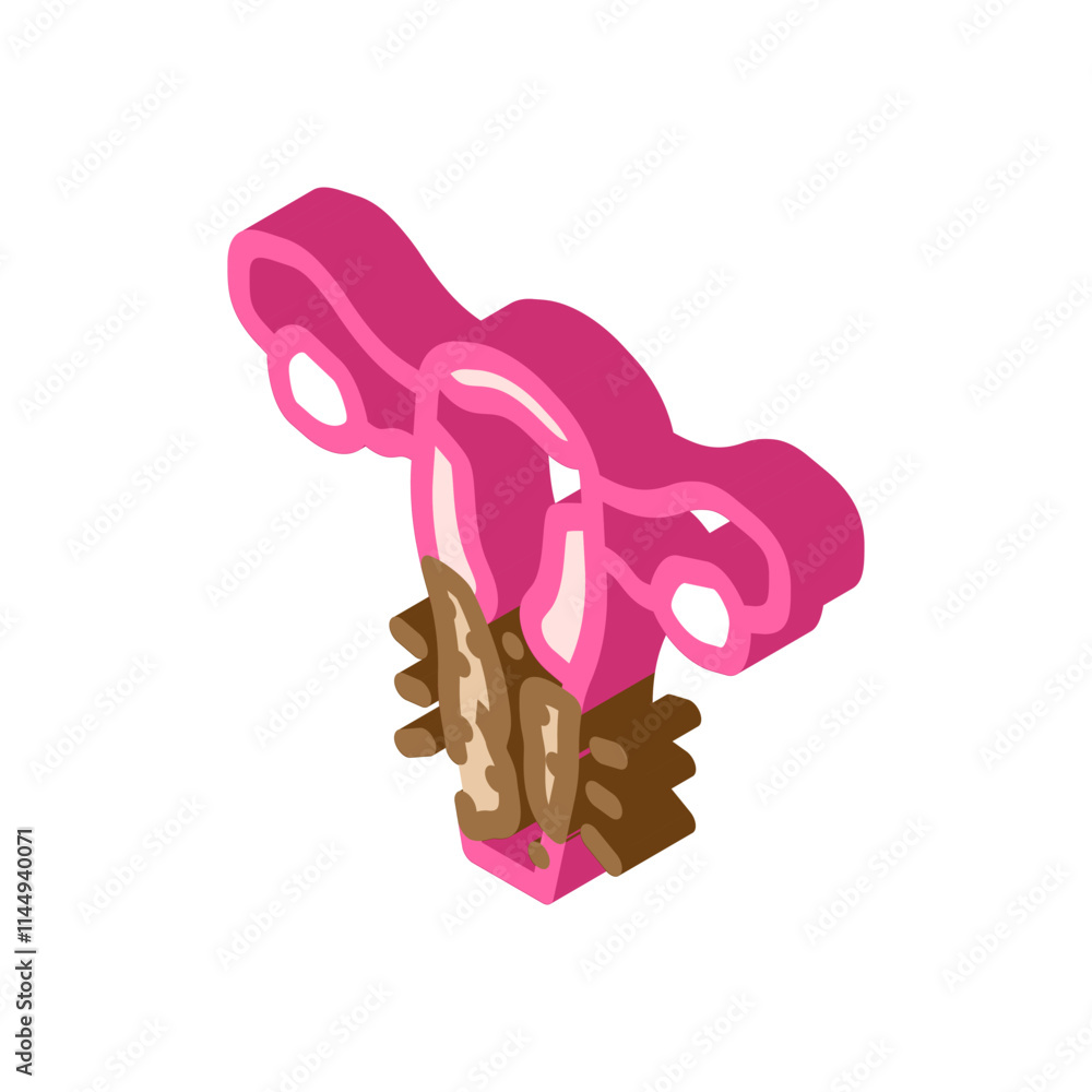 vaginal infections woman disease isometric icon vector. vaginal ...