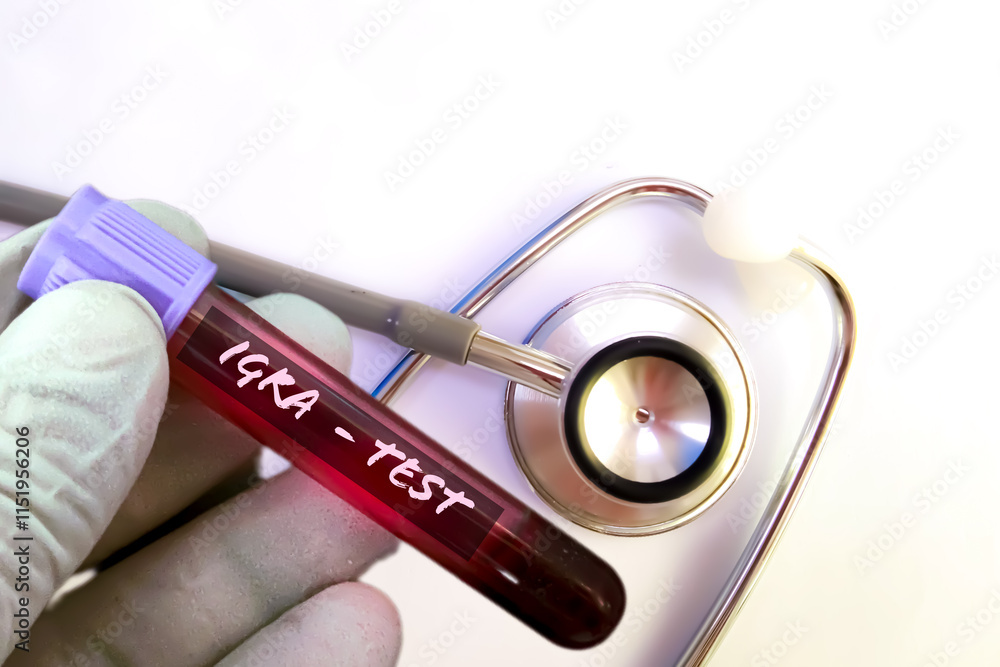 Blood sample for IGRA(interferon gamma release assay) test for ...