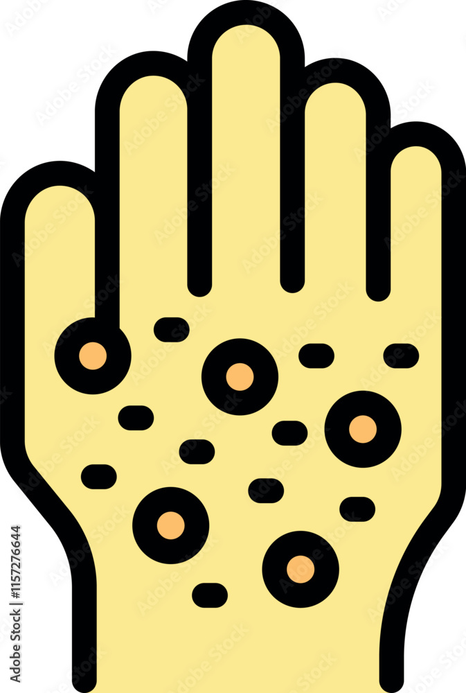 Monkeypox virus causing skin blisters and rashes on a hand, a symptom ...