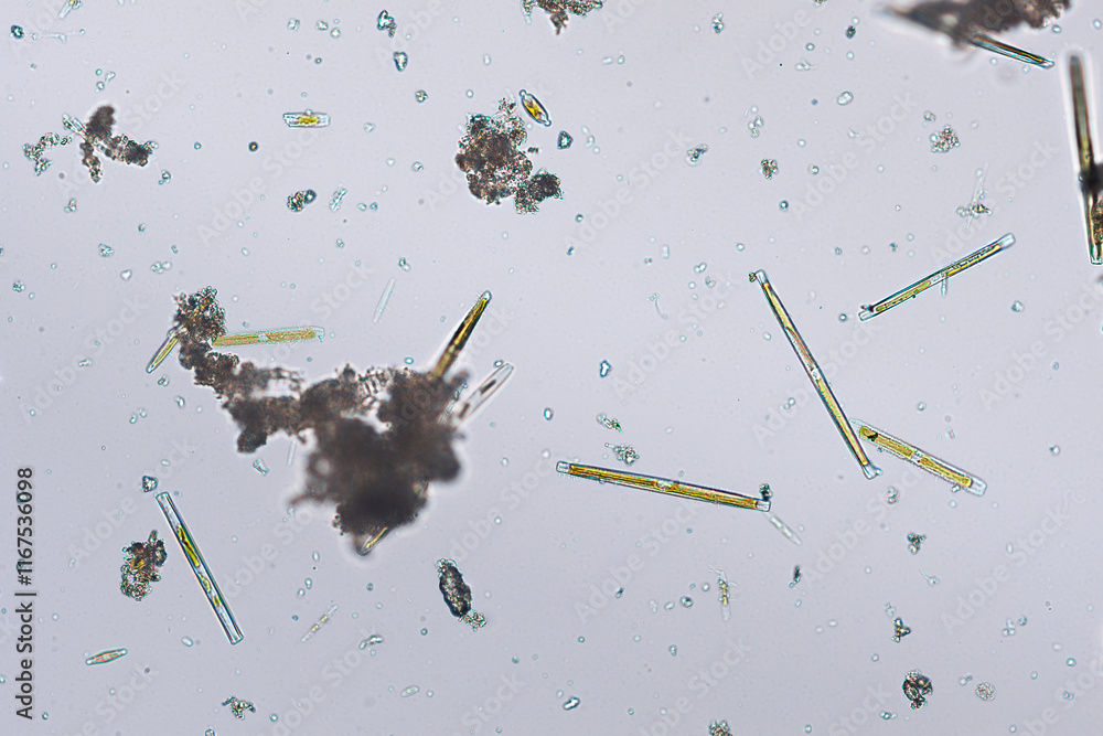 Foto de Stock freshwater diatom algae from a river under the microscope ...