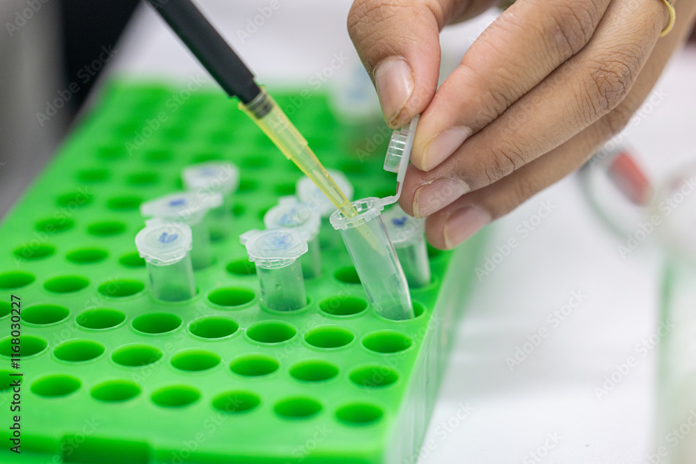 Polymerase Chain Reaction (PCR) and Agarose gel electrophoresis is a ...