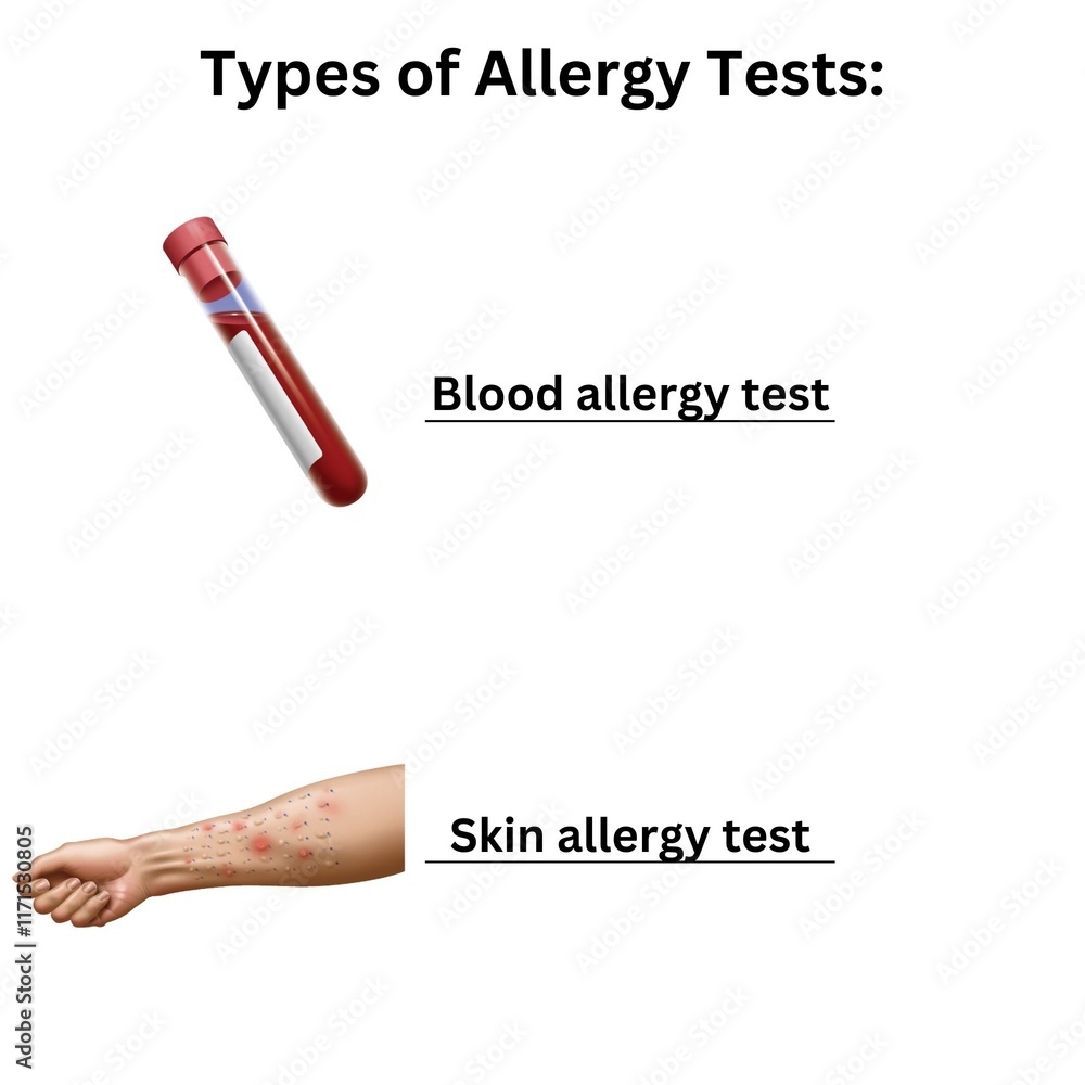 Illustration showing the different types of allergen tests - blood and ...
