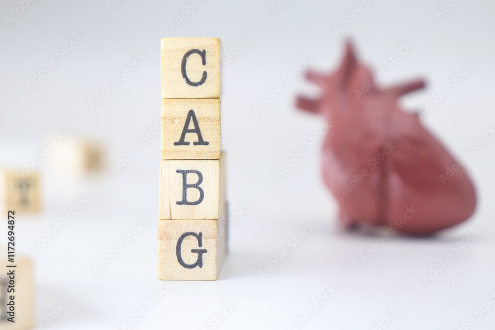 Coronary Artery Bypass Graft acronym. CABG letters written on wooden ...