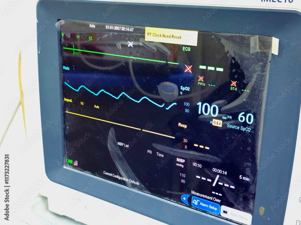 Cairo, Egypt, December 31 2024: Vital signs medical monitor for ...