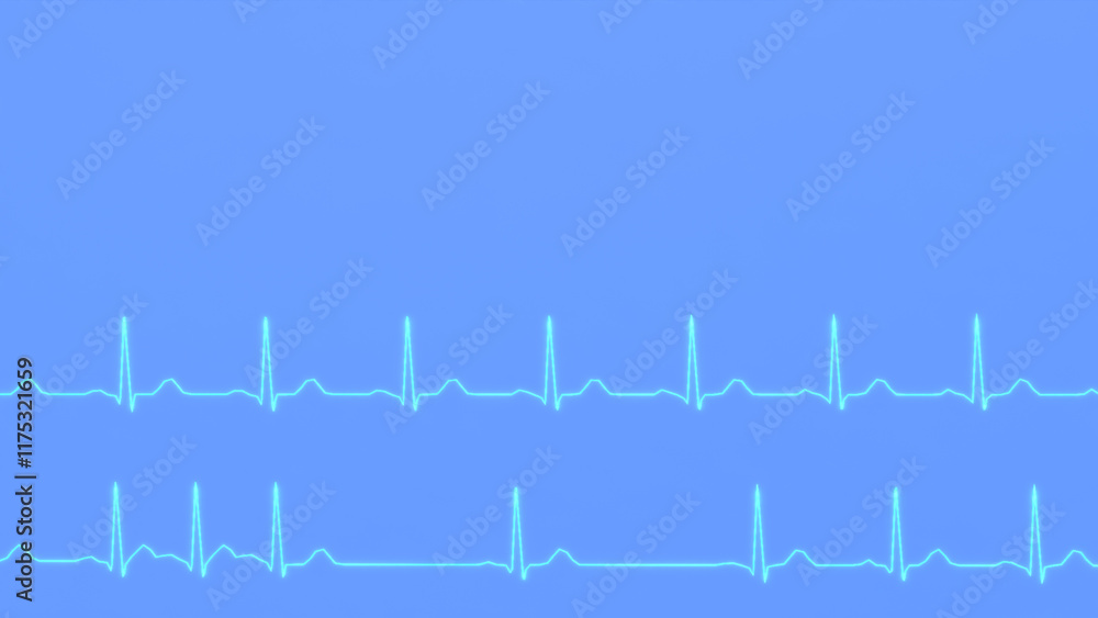 ECG graphs comparison of normal heart rhythm and arrhythmia Stock Photo ...