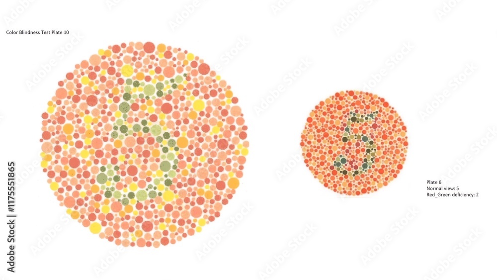 Color vision test or Color Blindness Test Plate 10 and other Plate 6 ...