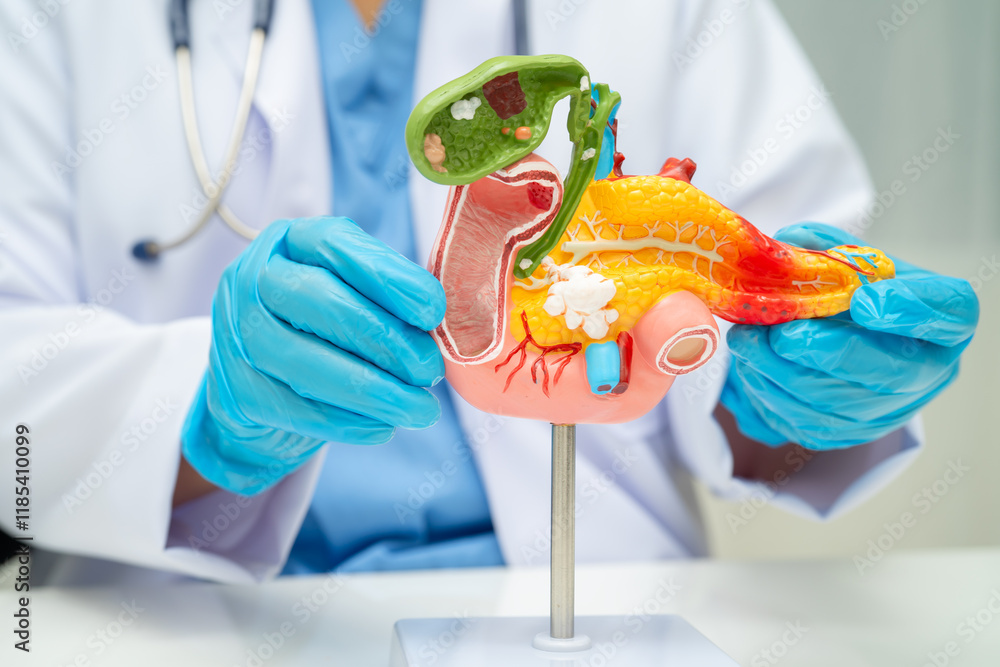 Pancreatitis, pancreatic cancer, Asian doctor with pancreas ...