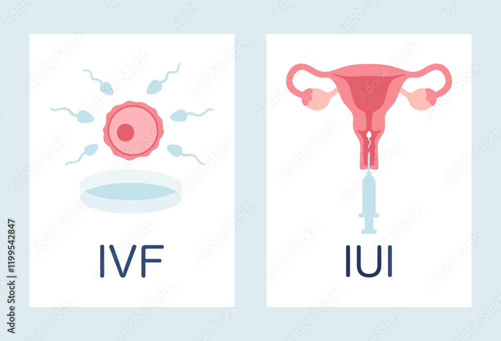 In vitro fertilization IVF and intrauterine insemination IUI ...