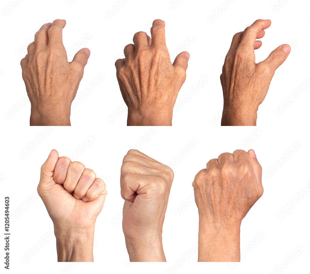 Elderly woman's hand outstretche, clenched fist transitioning to open ...