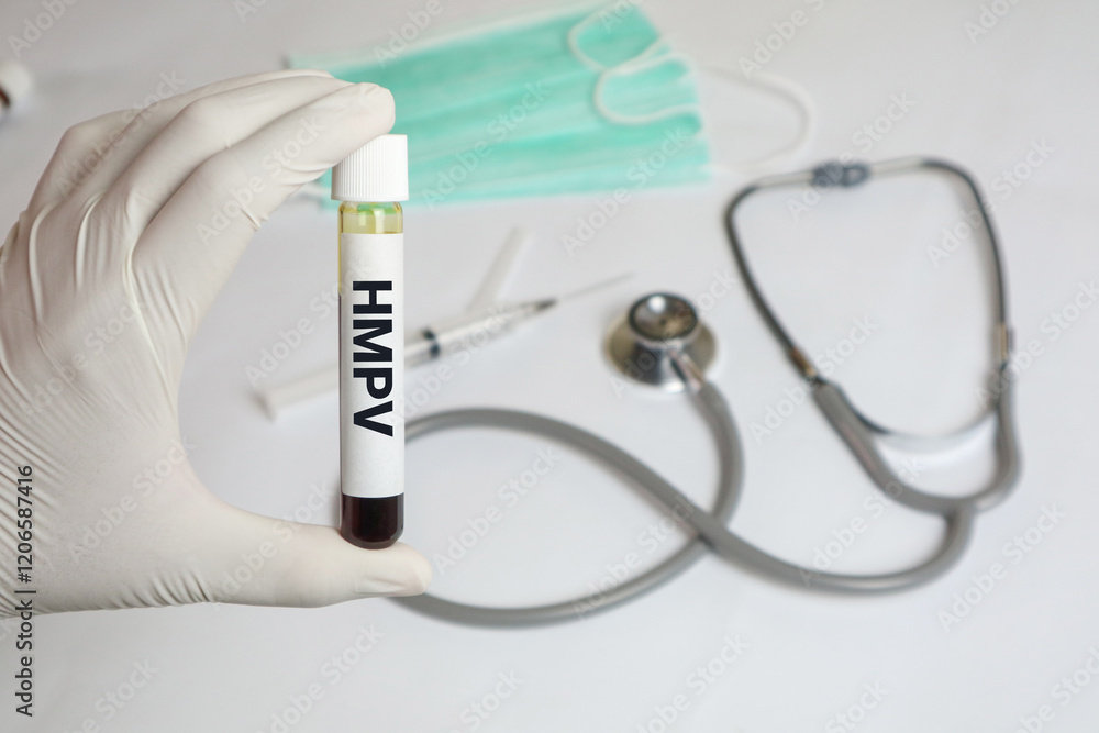 Genital warts. Blood sample to test for HPV. Human papillomavirus or ...