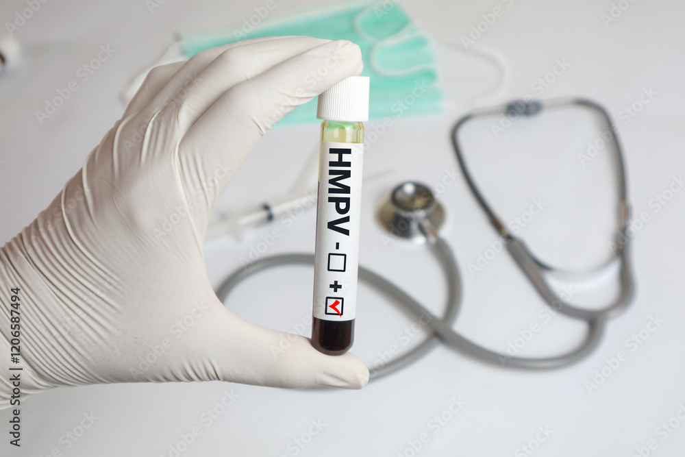 Doctor holding a test blood sample tube with Human metapneumovirus ...