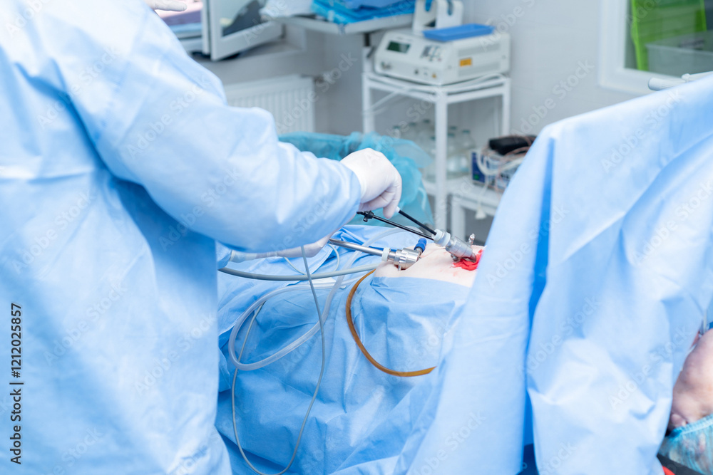 abdominal surgery, laparoscopy, cholecystectomy, removal of the ...
