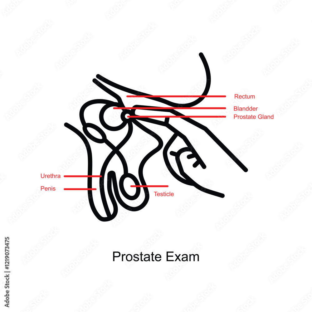 Prostate exam. Digital rectal examination. Prostate cancer diagnosis ...