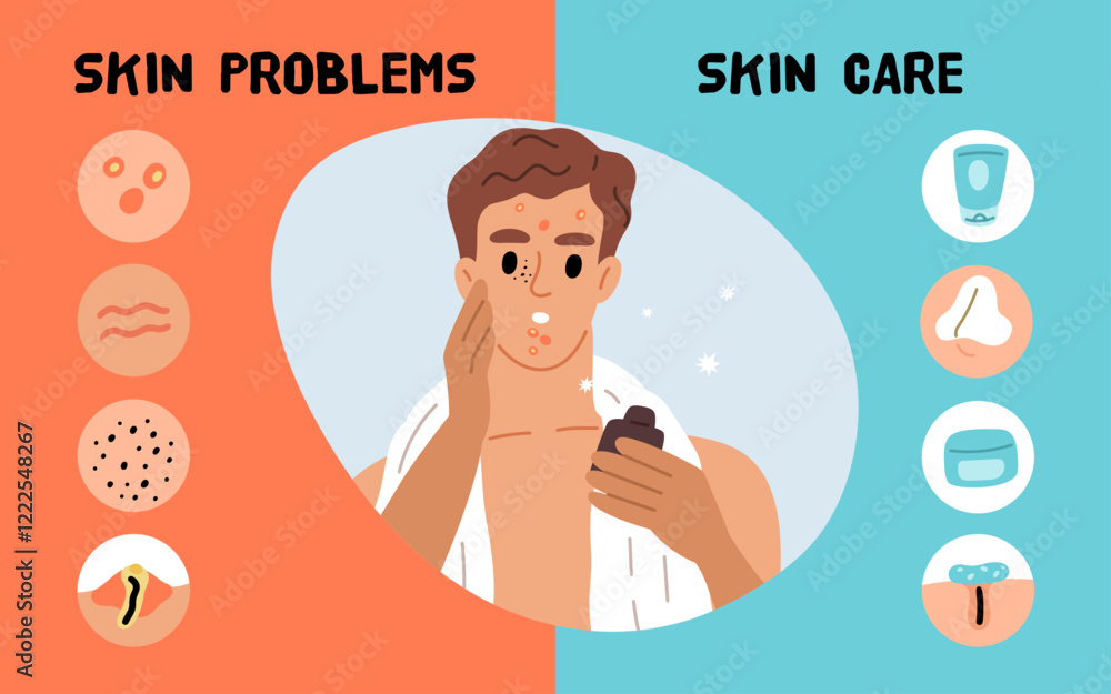 Acne prevention infographic. Man with problem face skin. Guy with ...