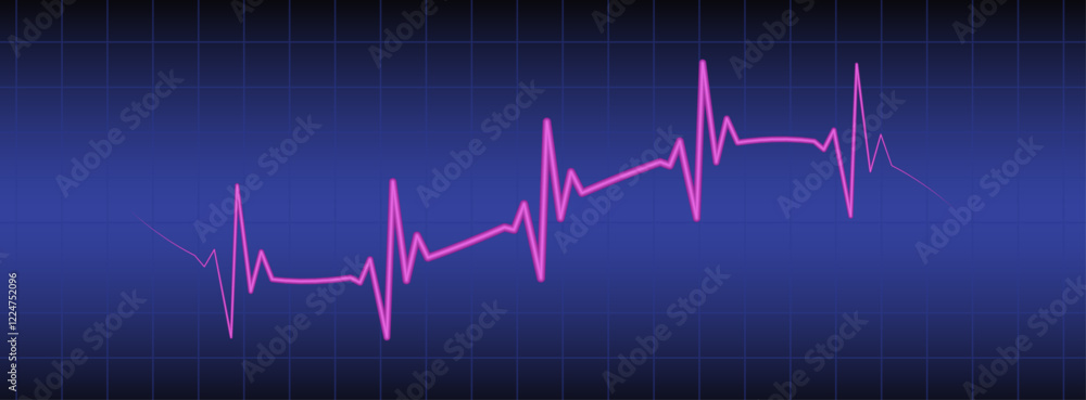 Editable 3d pink ekg, medical monitor background heart rhythm diagram ...