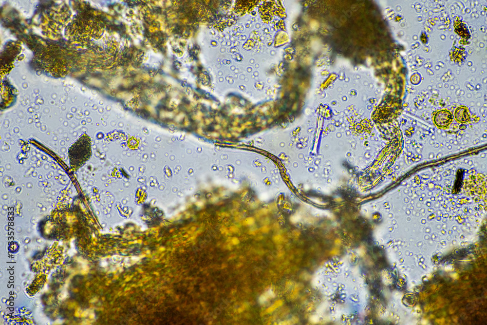 soil fungi on a farm soil microbes under the microscope. microorganisms ...