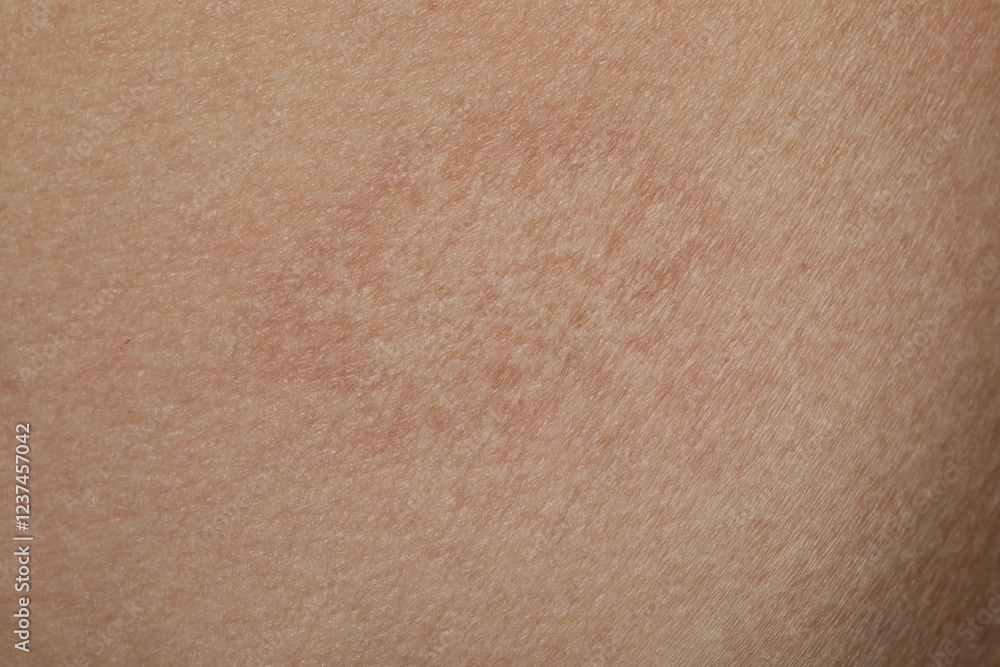Texture of skin with scar as background, closeup Stock Photo | Adobe Stock