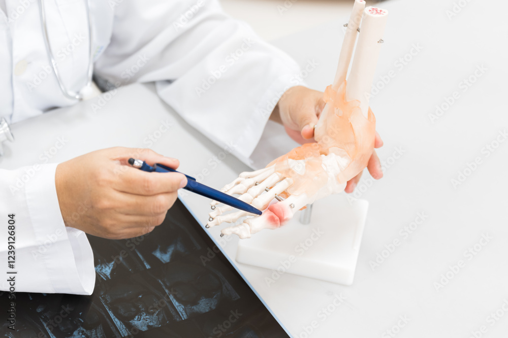 Orthopedist explain to the patient for human foot bone injury treatment ...