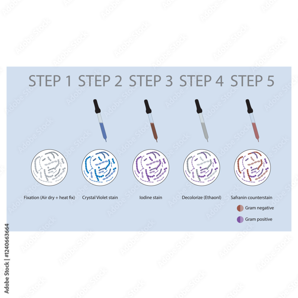 Diagram showing gram staining technique steps - microbiology laboratory using Crystal violet and ...