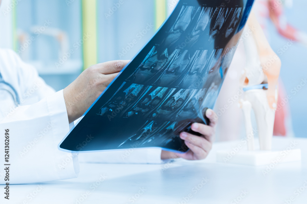 Doctor holding patient bone x-ray film before surgery.Image MRI and CT ...
