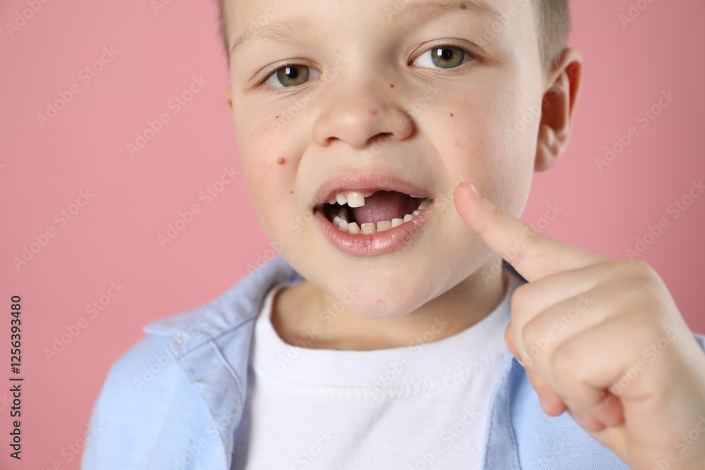 Cute little boy pointing at his missing tooth on pink background ...