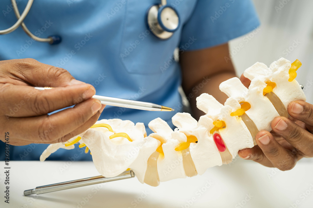 Asian doctor holding spinal nerve and bone model, Lumbar spine ...