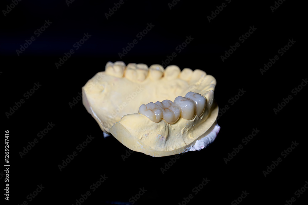 Upper jaw tooth model made of yellow dental stone. In the left region ...