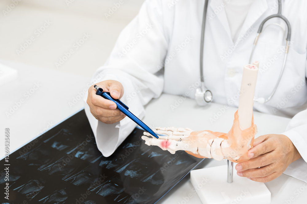 Orthopedist explain to the patient for human foot bone injury treatment ...